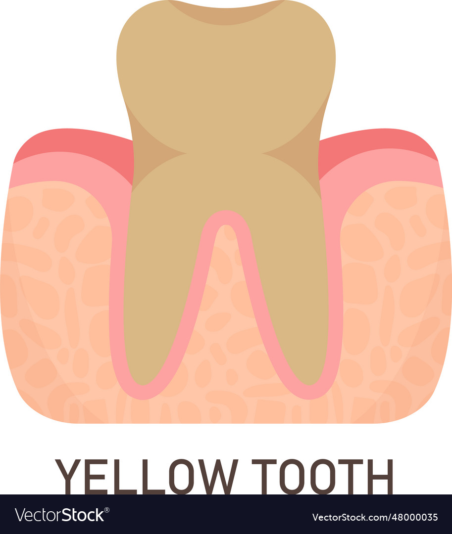 Yellow tooth problem Royalty Free Vector Image