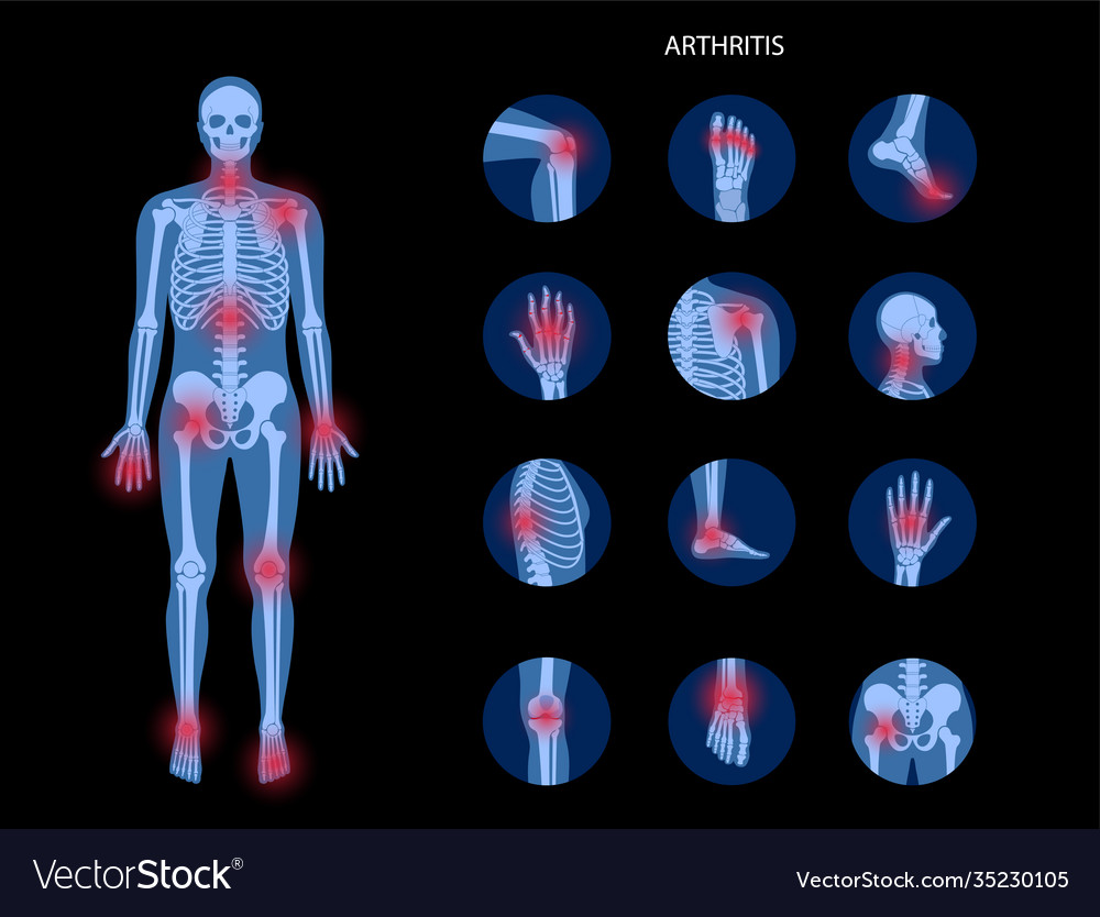 Human bones concept Royalty Free Vector Image - VectorStock