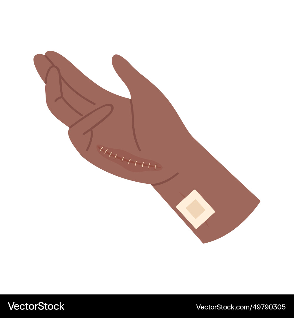 Injured hand with stitches Royalty Free Vector Image