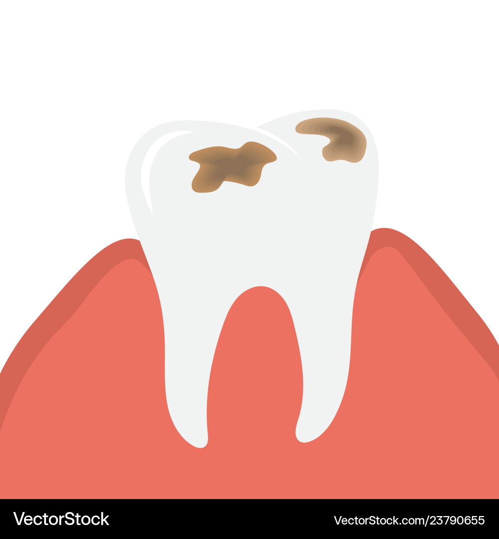 Decay and destroy tooth or dental caries Vector Image
