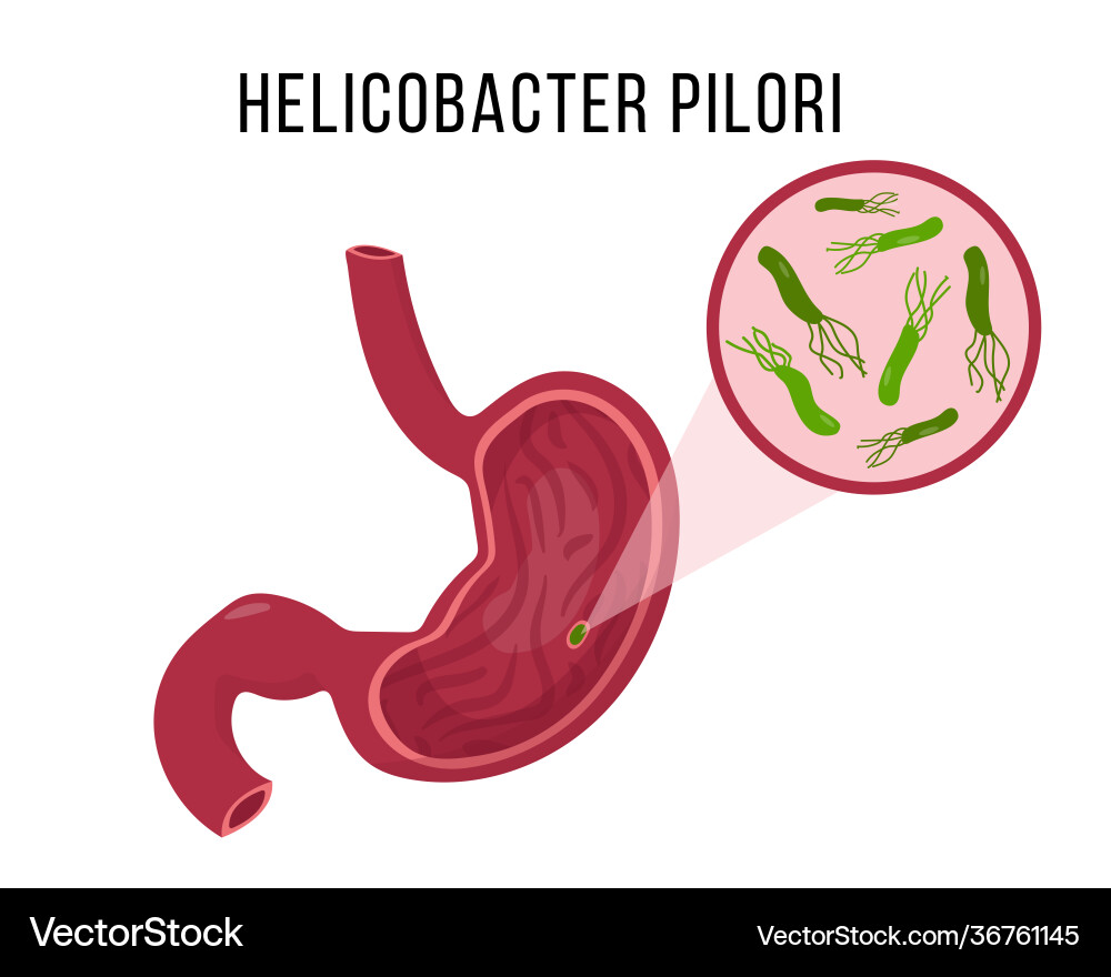 Human stomach infected helicobacter pilori Vector Image