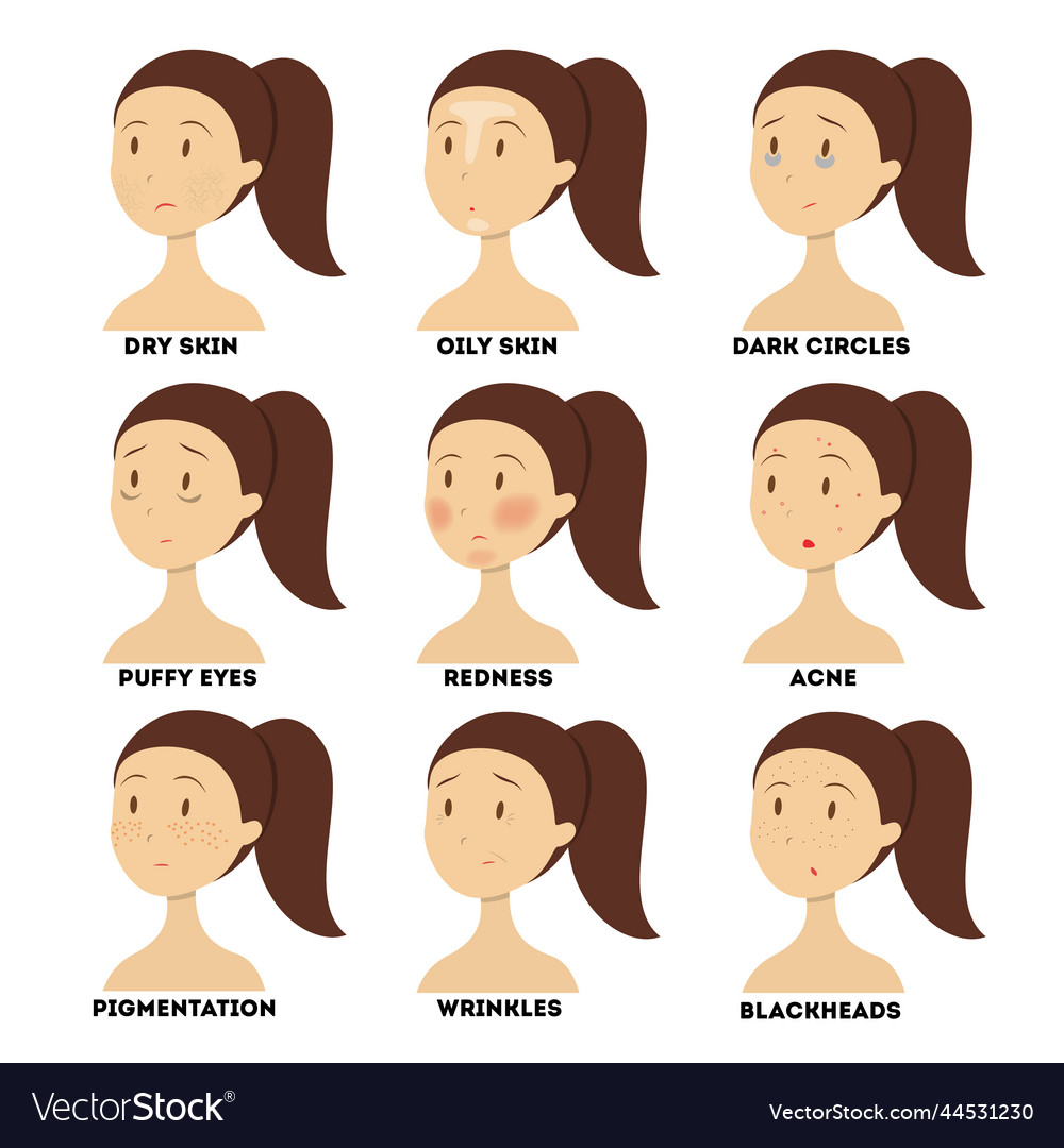 Face problems set Royalty Free Vector Image - VectorStock