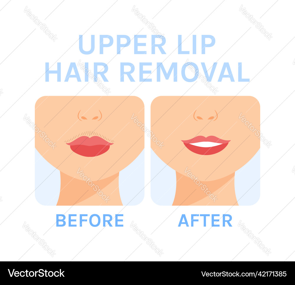 Female mustache depilation face before after Vector Image