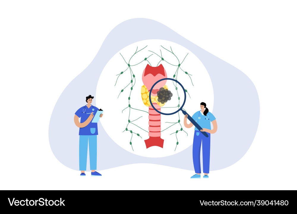 Thyroid cancer stages Royalty Free Vector Image