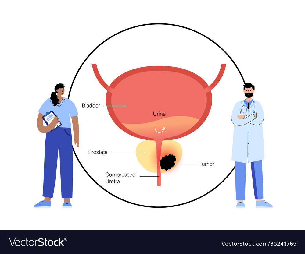 Man reproducive system problems Royalty Free Vector Image