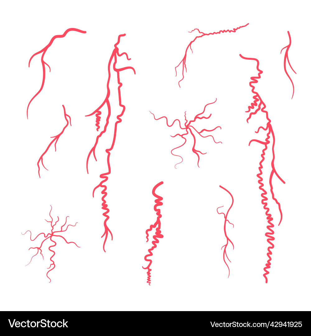 Varicose veins anatomy Royalty Free Vector Image