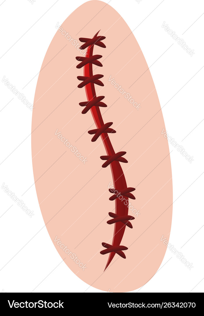 Cross suture icon cartoon style Royalty Free Vector Image