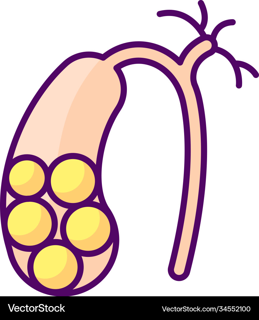 Gallstones rgb color icon Royalty Free Vector Image