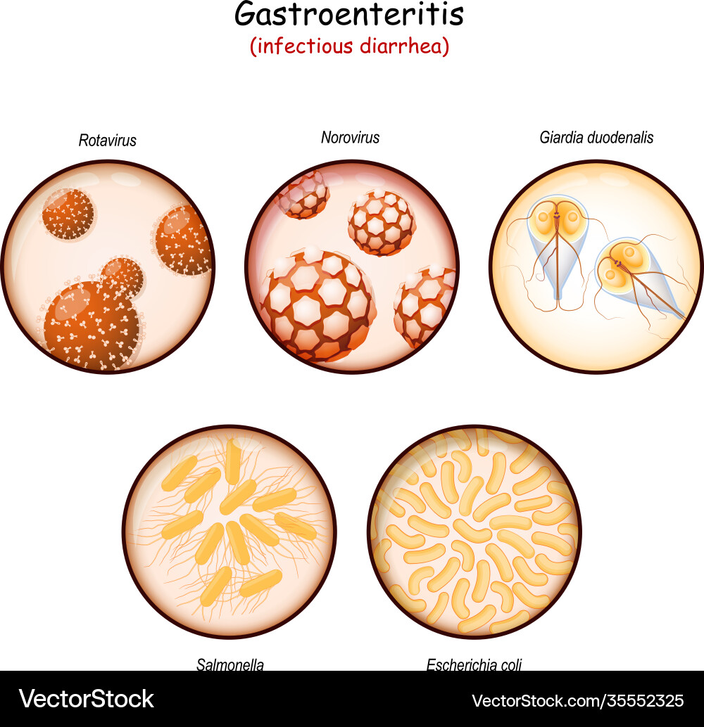 Infectious diarrhea close-up pathogens of Vector Image