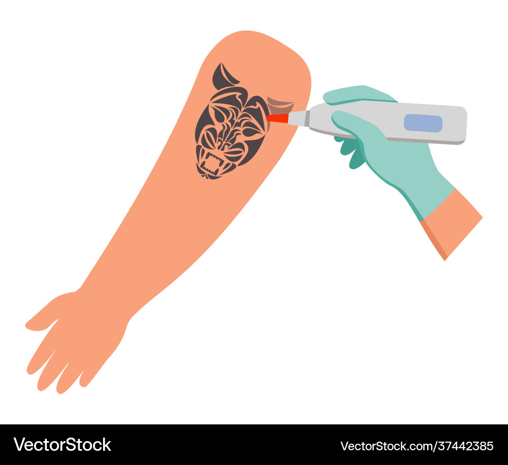 Tattoo removal from skin hand flat Royalty Free Vector Image