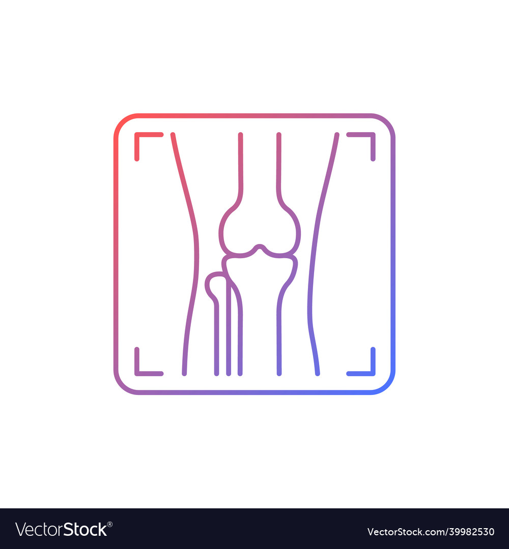 Arthritis x ray gradient linear icon Royalty Free Vector Arthritis x ray gradient linear icon Royalty Free Vector
