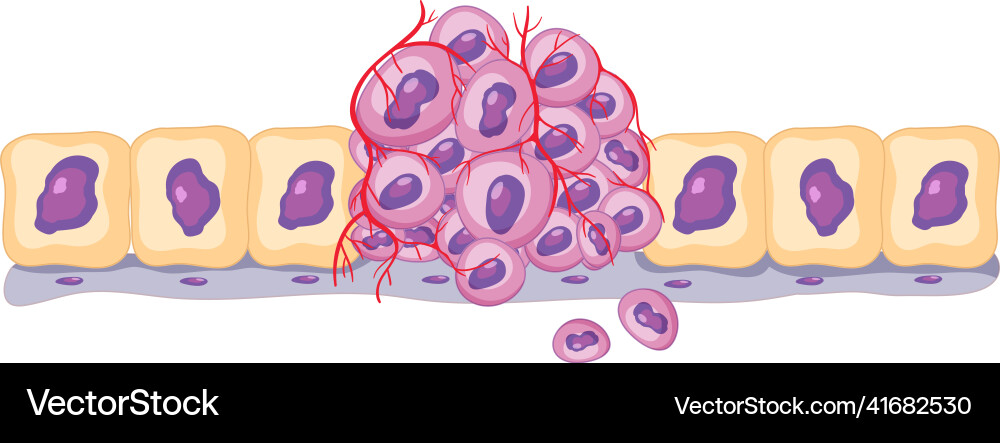 Isolated cancer cell on white background Vector Image