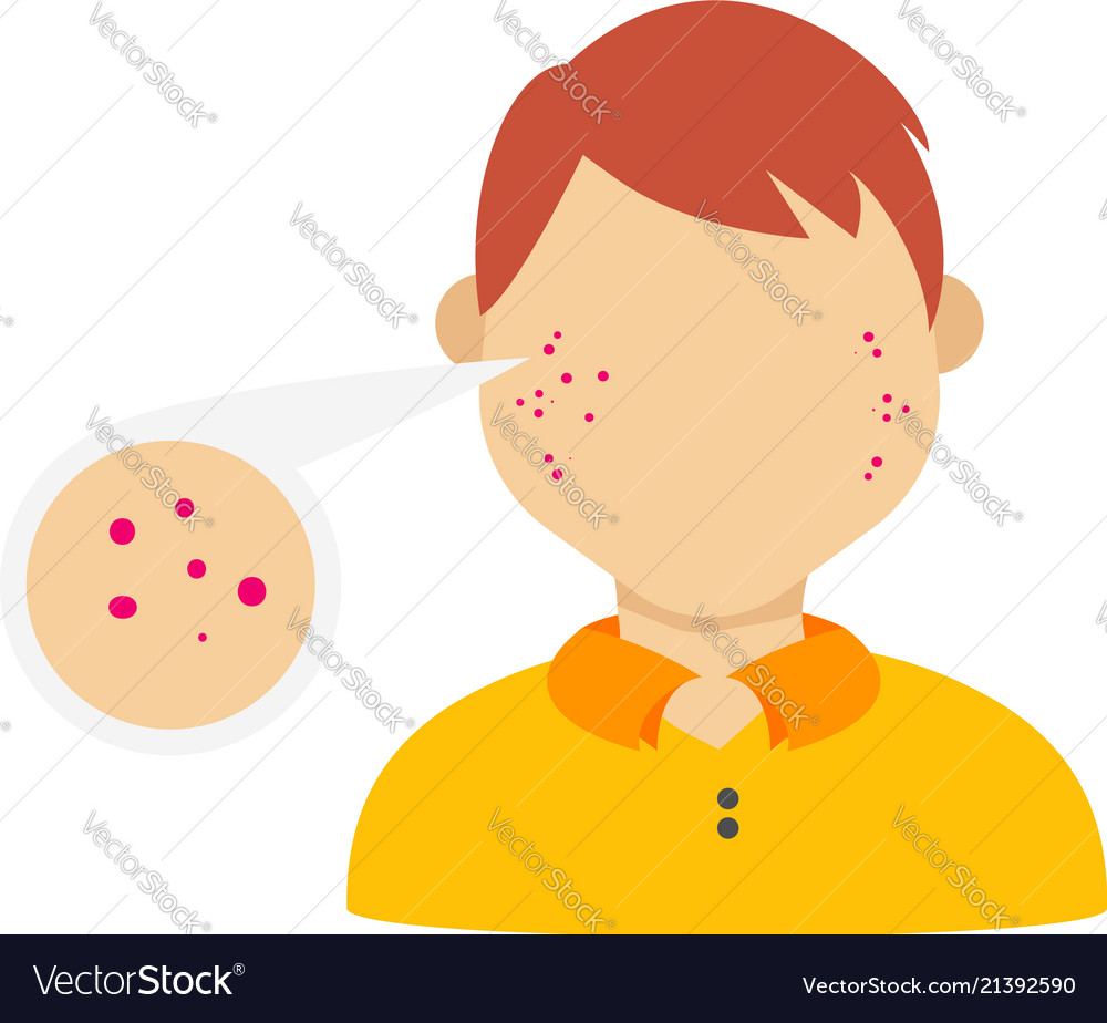 Infographics about dermatological problems Vector Image