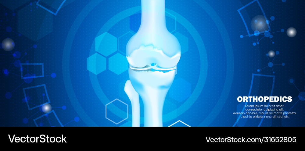 Medical orthopedic knee bone Royalty Free Vector Image