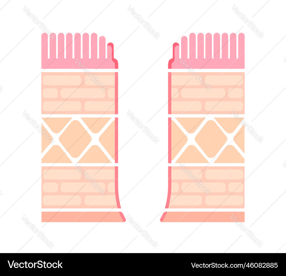 Sectional view of perforated ulcer Royalty Free Vector Image