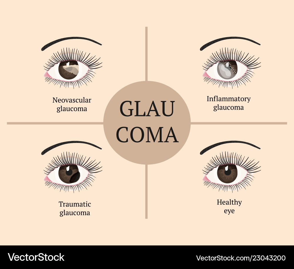 Eye disease ophthalmology health Royalty Free Vector Image