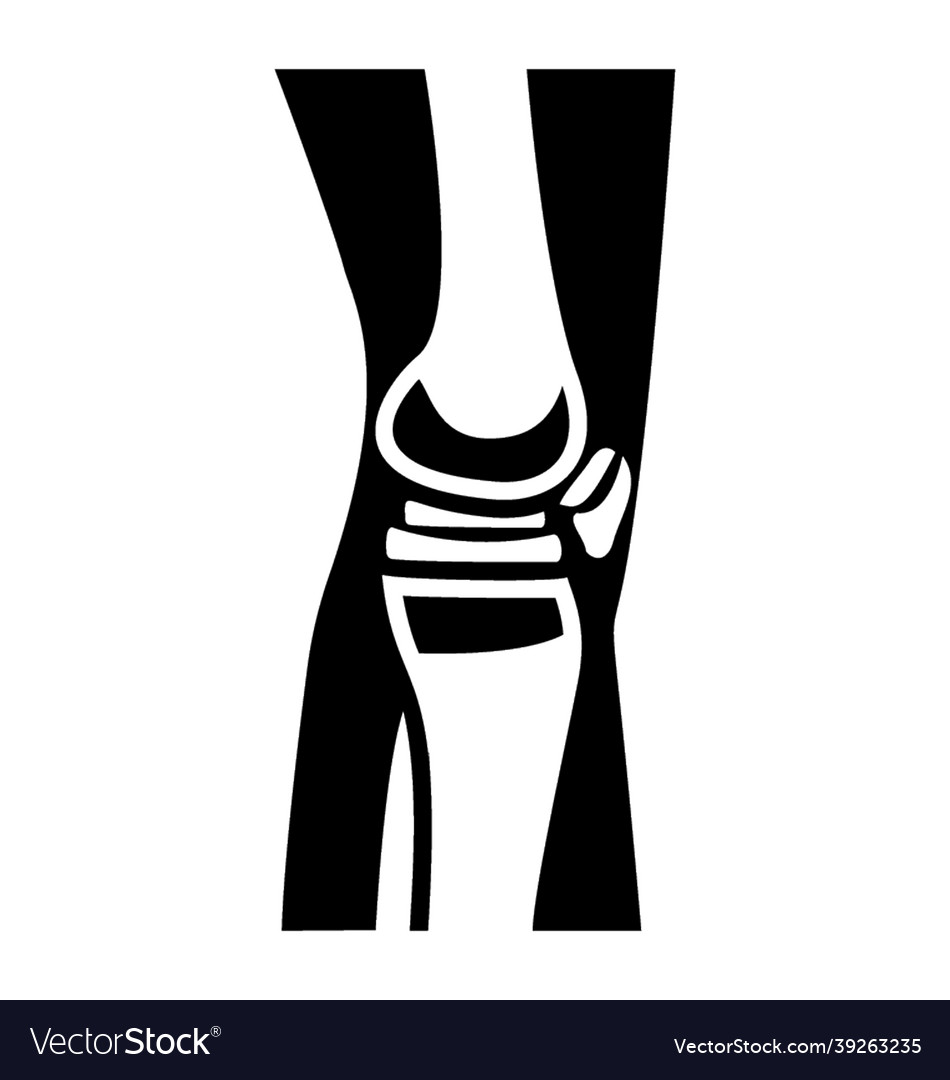 Knee joint Royalty Free Vector Image - VectorStock
