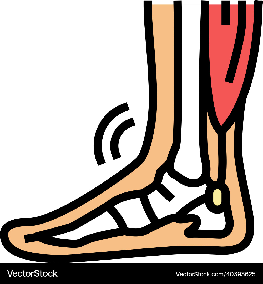 Tendonitis problem color icon Royalty Free Vector Image