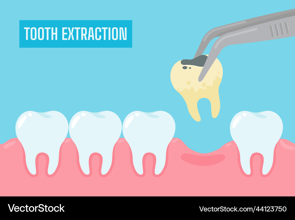Extraction of teeth cartoon yellow Royalty Free Vector Image