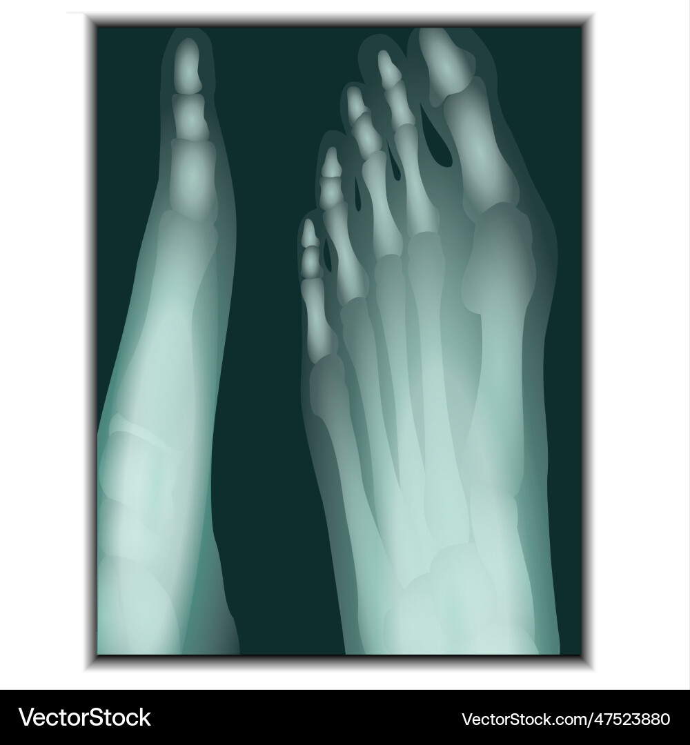 X-ray of foot claw Royalty Free Vector Image - VectorStock