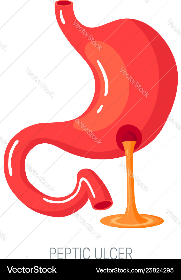 Peptic ulcer concept in flat style icon Royalty Free Vector