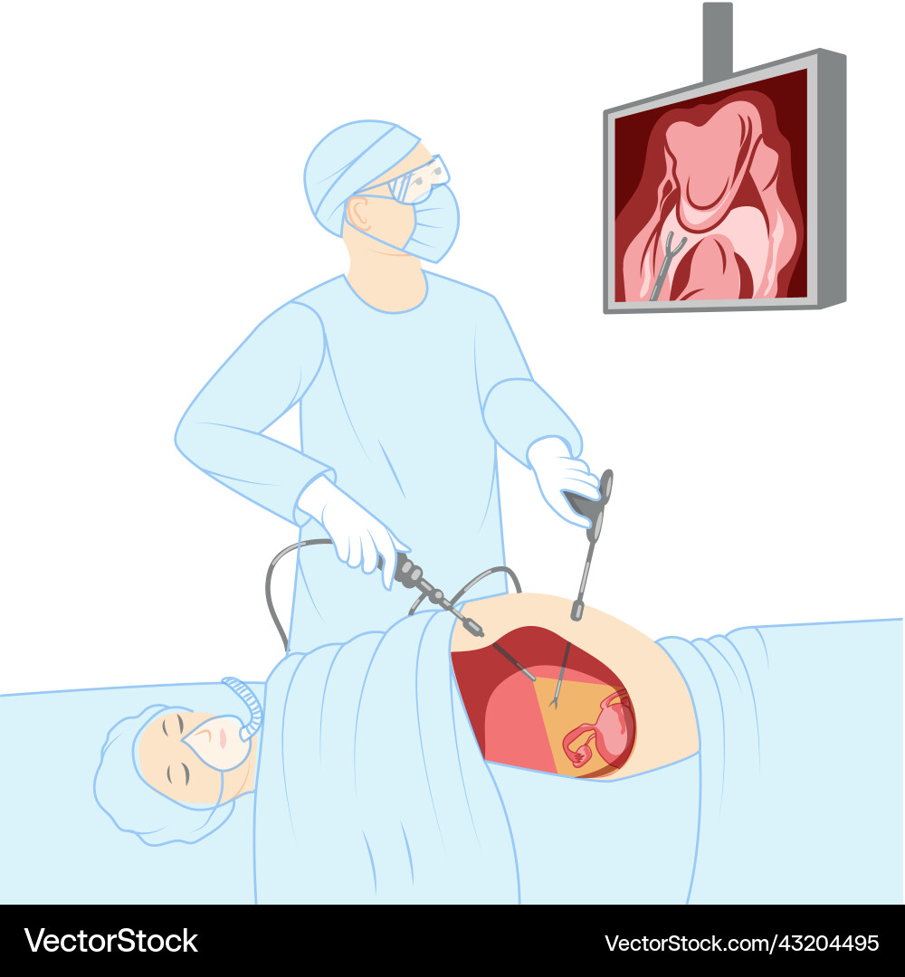 Laparoscopy keyhole surgery doctor with a patient Vector Image