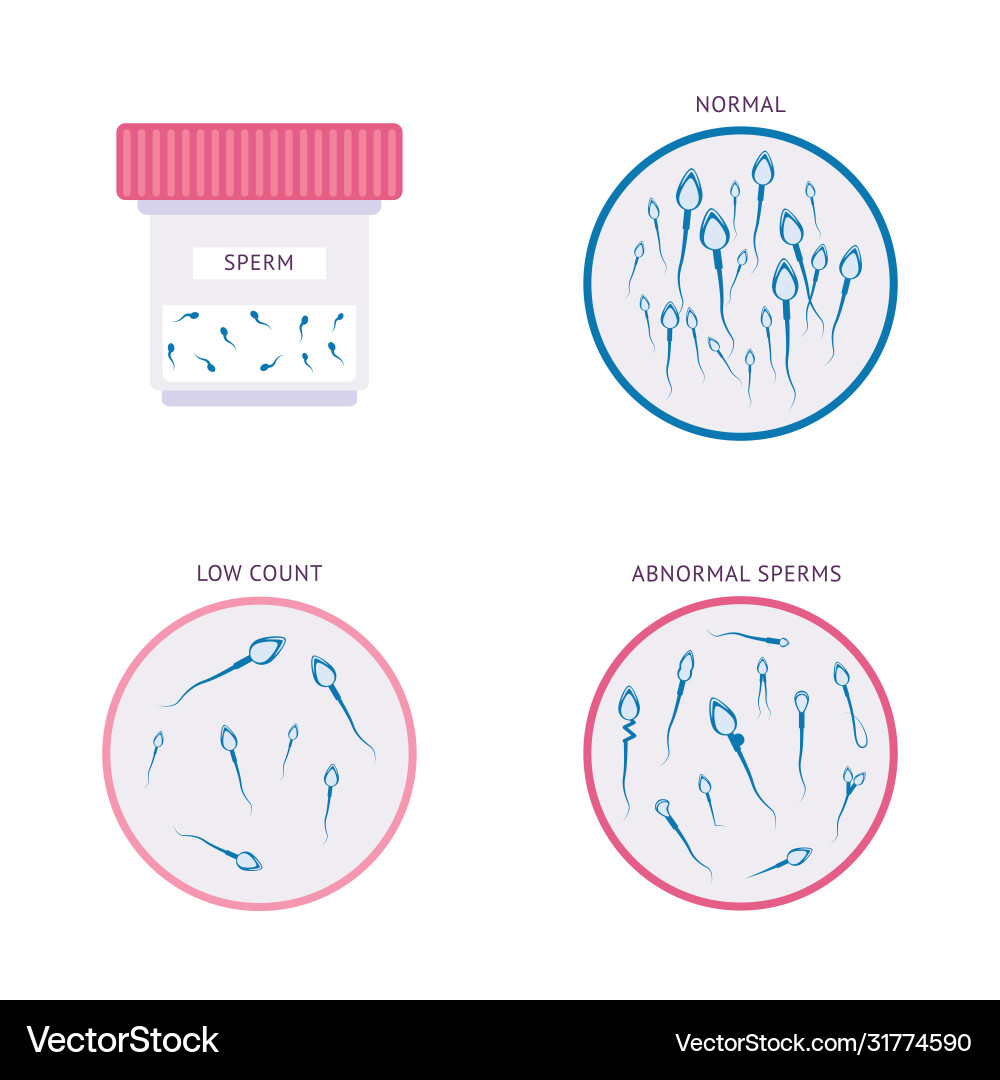 Isolated male infertility set - sperm types Vector Image