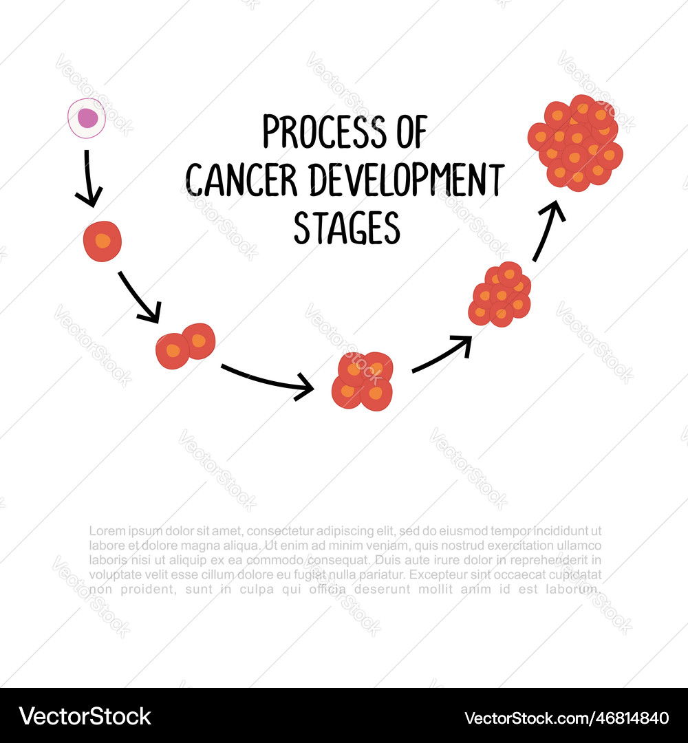 Process of cancer development stages isolated on Vector Image