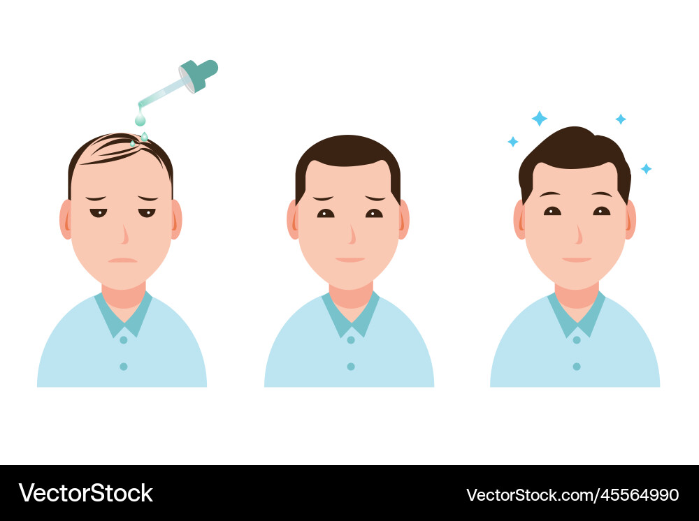 Treatment hair loss Royalty Free Vector Image - VectorStock