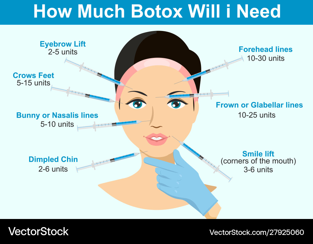 How much botox will i need infographics botox Vector Image