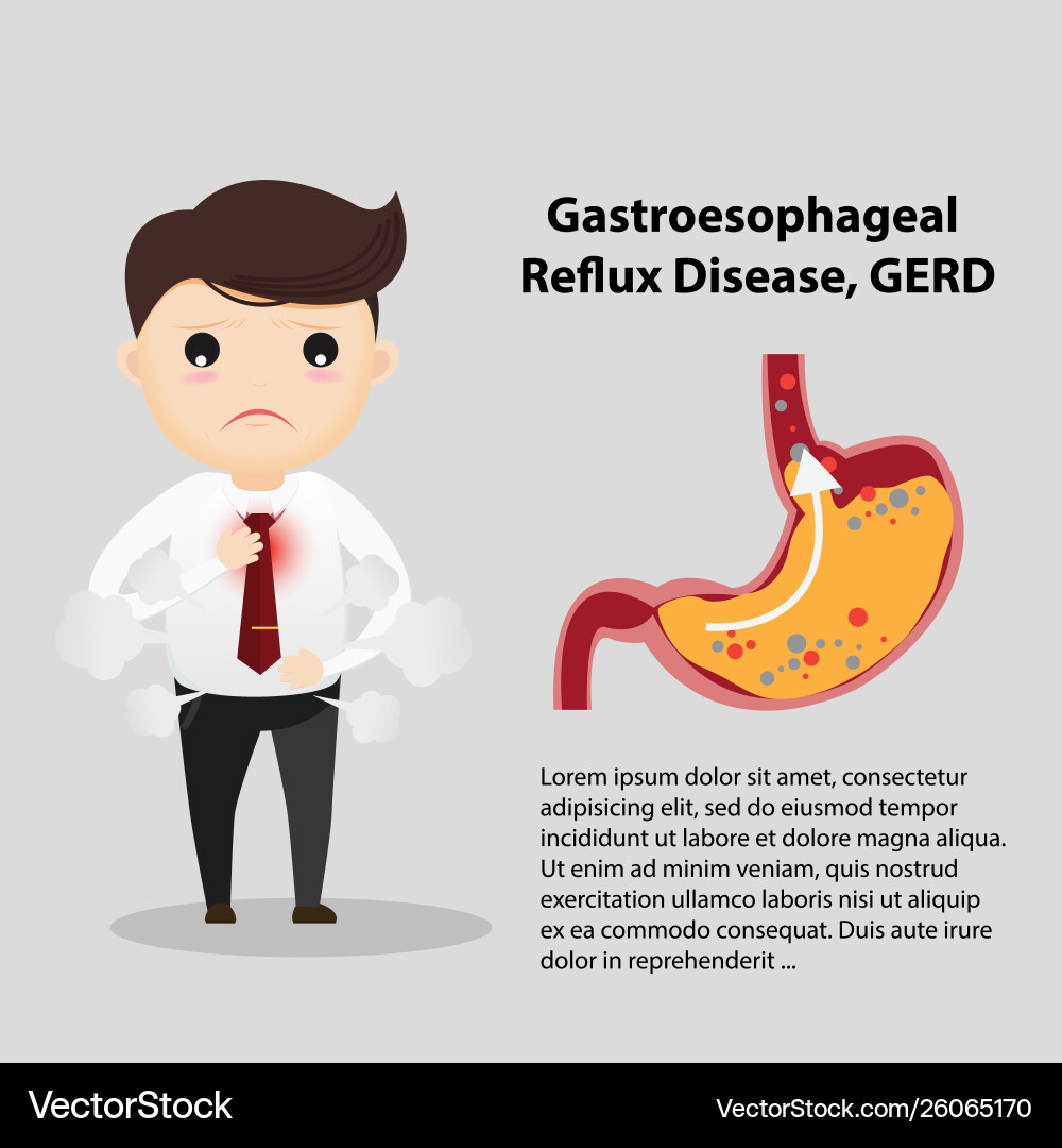 Gastro-esophageal reflux disease gerd Royalty Free Vector