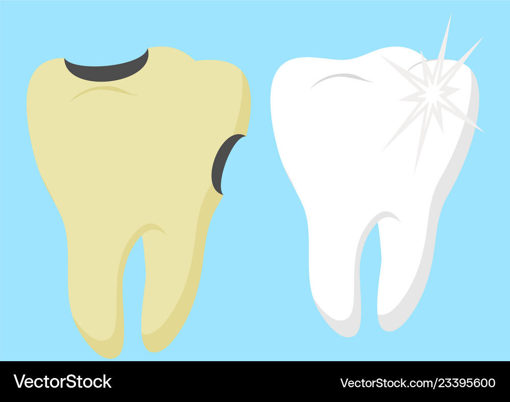 Healthy cartoon tooth and decayed tooth Royalty Free Vector