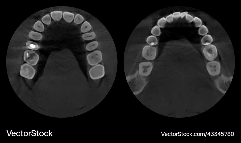 Teeth realistic 3d scan jaw dental mri with Vector Image