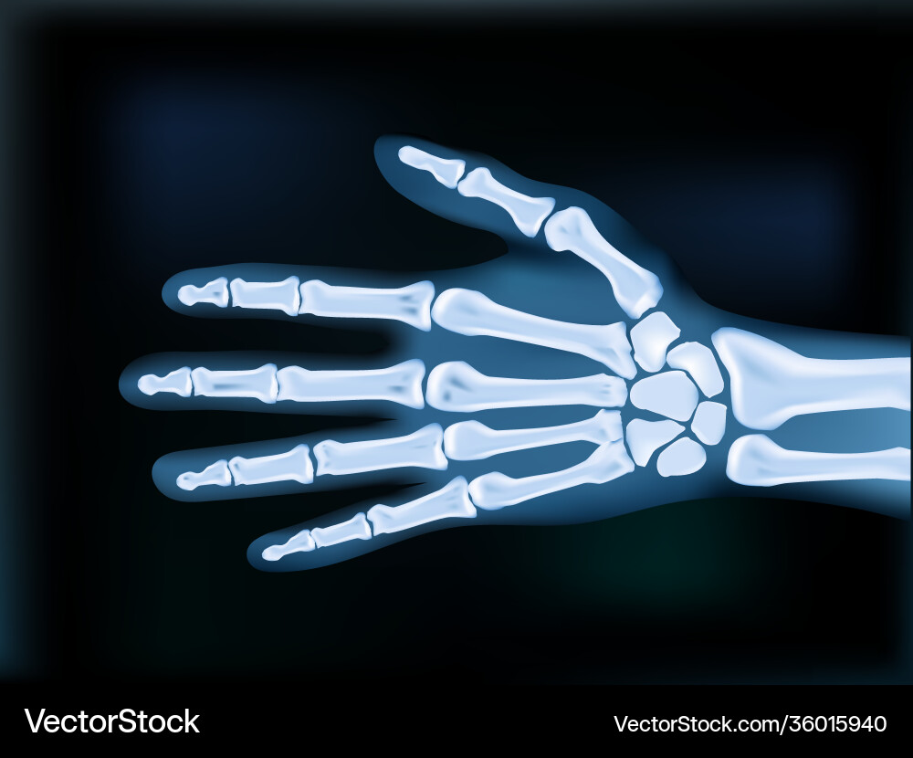 Realistic 2d x-ray hand dark medical image Vector Image