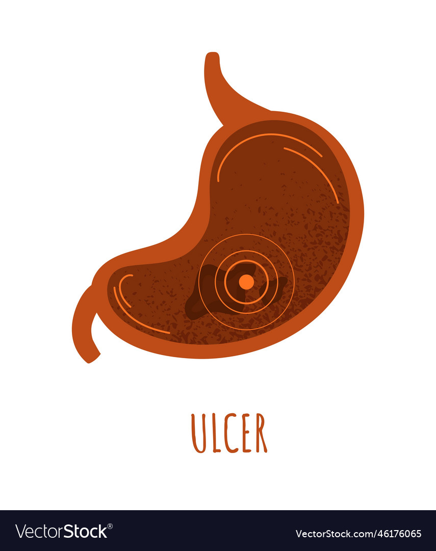 Ulcer in stomach concept Royalty Free Vector Image