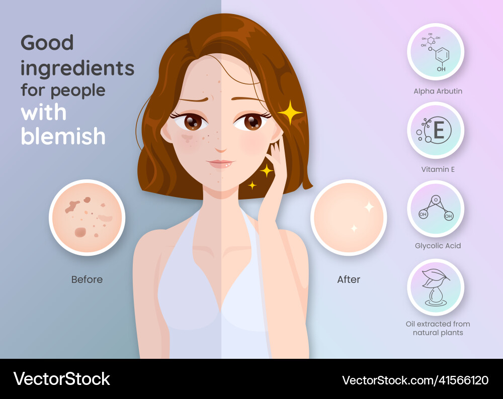 Good ingredients for people with blemish Vector Image