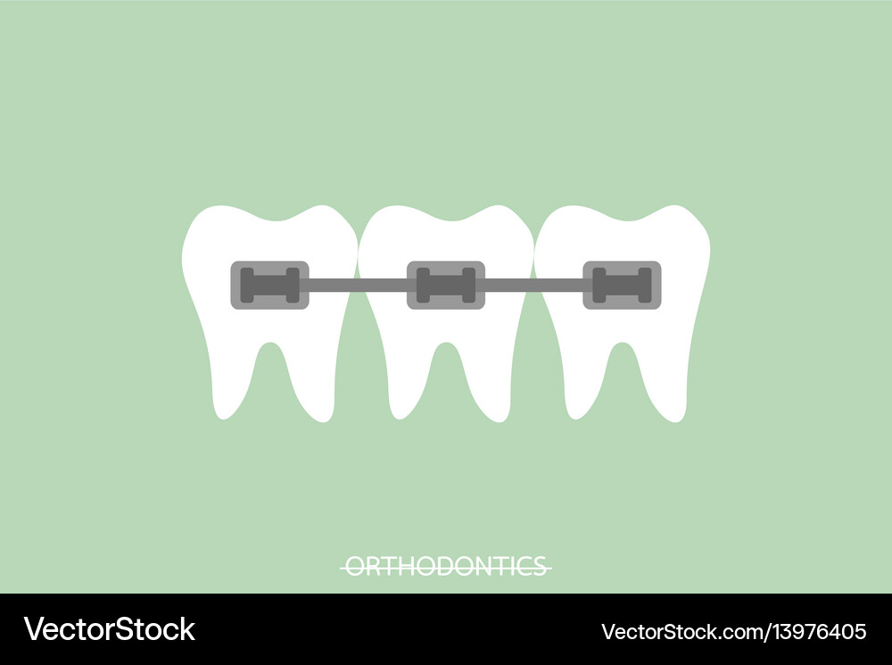 Orthodontics teeth or dental braces Royalty Free Vector