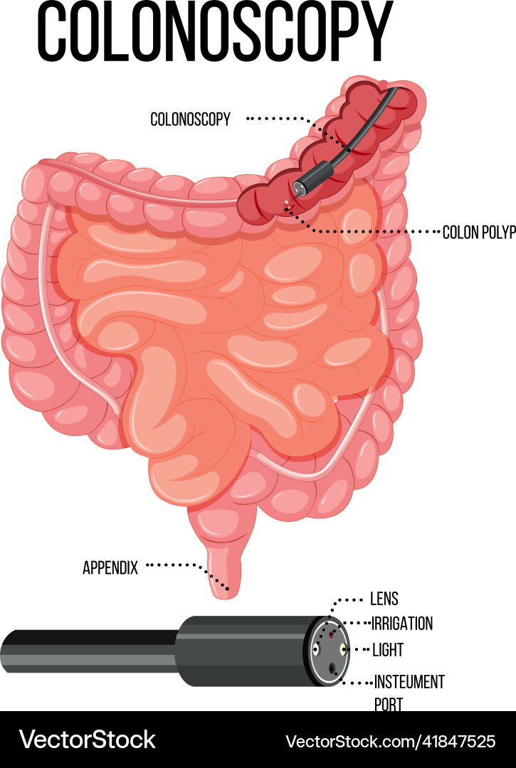 Human Appendix Diagram