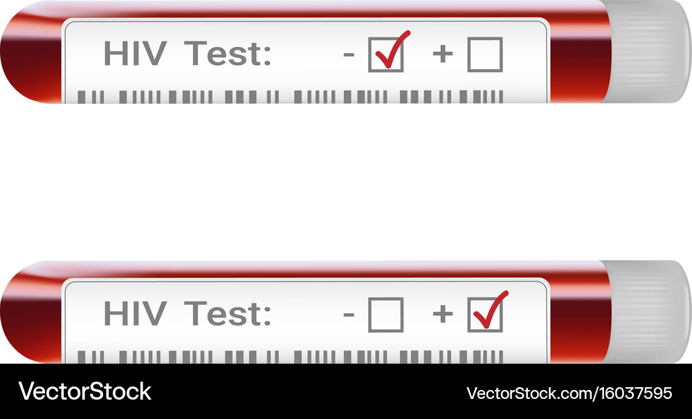 Hiv screening test result concept with blood Vector Image