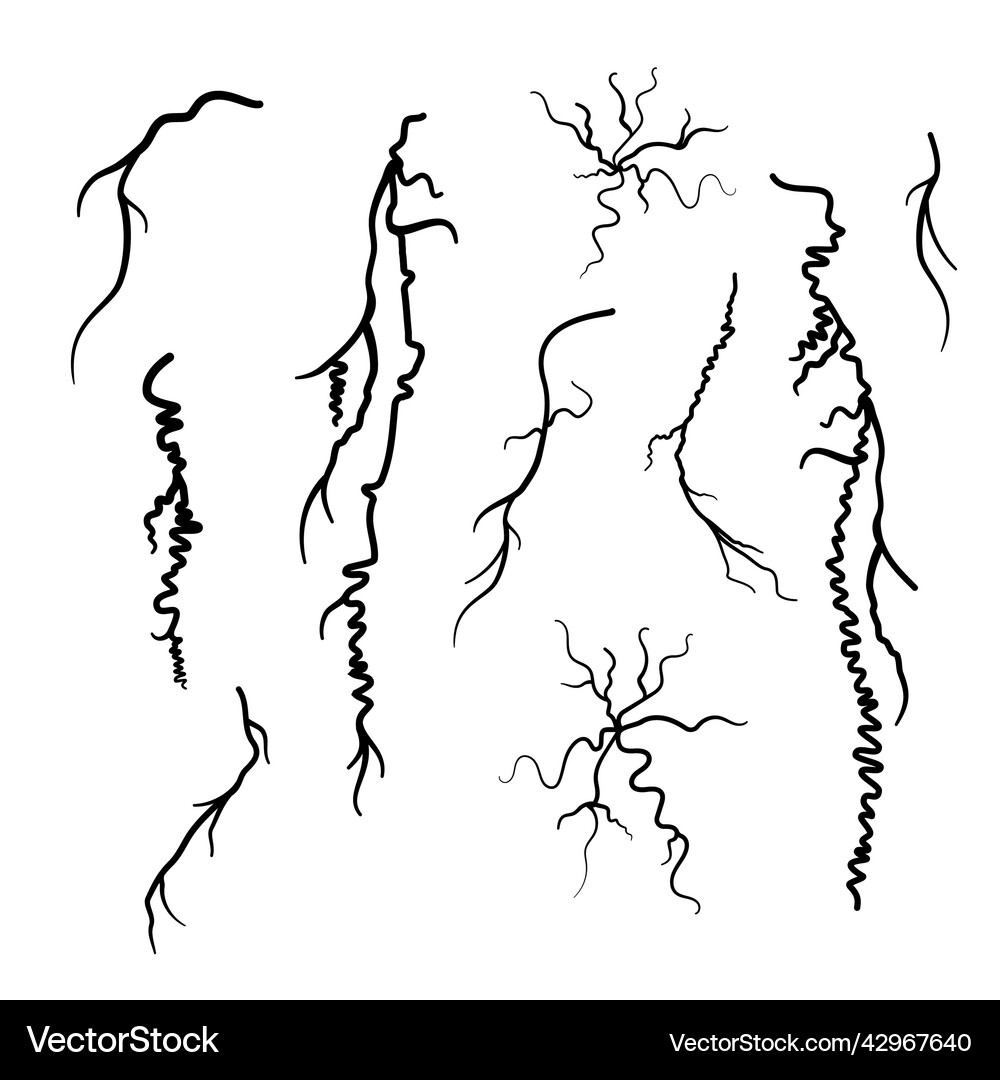 Varicose veins anatomy Royalty Free Vector Image