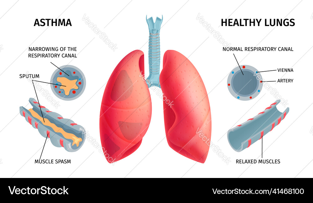 Human lung anatomy infochart Royalty Free Vector Image