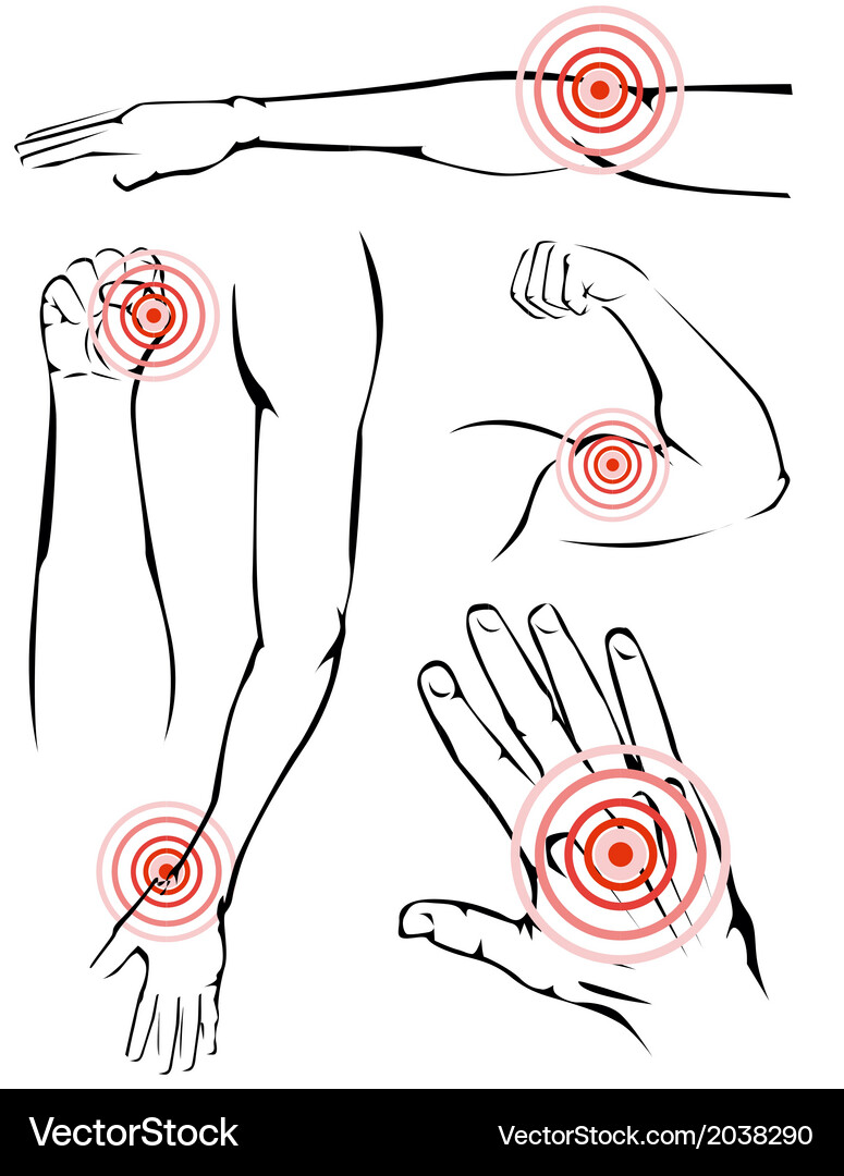 Arm pain Royalty Free Vector Image - VectorStock