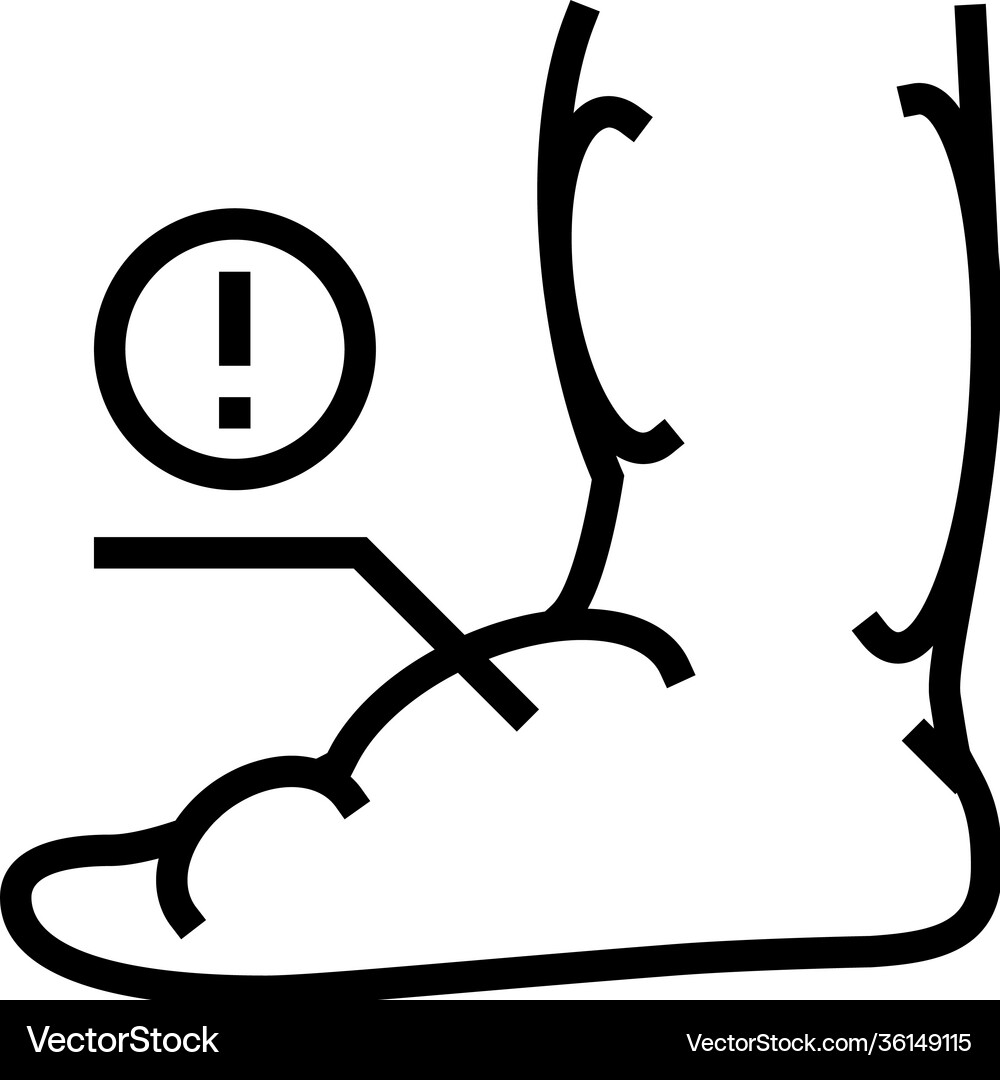 Leg edema critical health problem line icon Vector Image