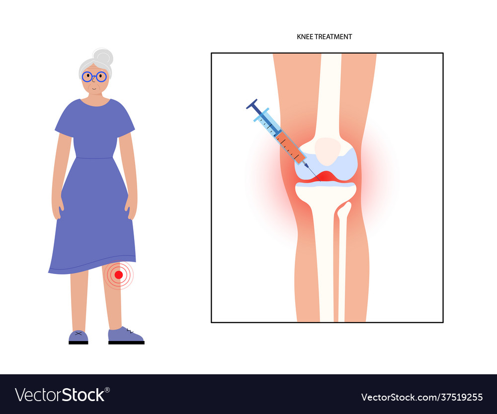 Knee injection concept Royalty Free Vector Image