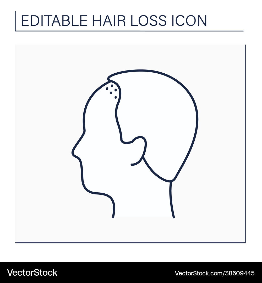 Hair loss line icon Royalty Free Vector Image - VectorStock
