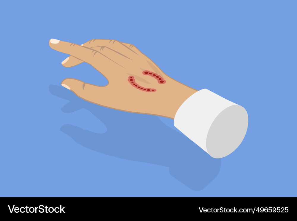 3d isometric flat of dog bite Royalty Free Vector Image