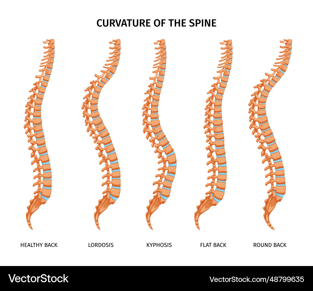 Spine curvature anatomy set Royalty Free Vector Image