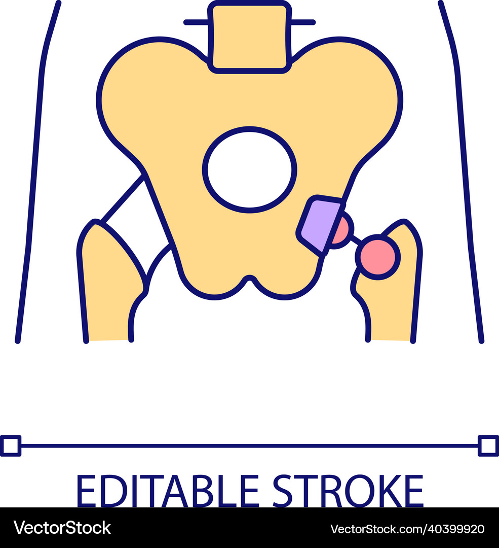 Hip Replacement Icon - Medical Implant Royalty Free Vector