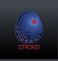 Brain Stroke Vector Images (over 5,600)