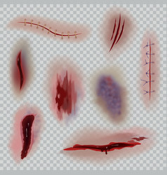 Surgical stitches scars Royalty Free Vector Image
